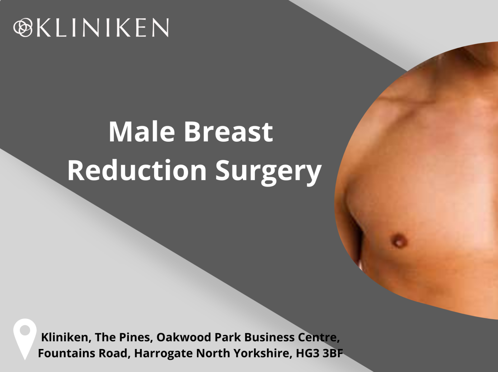Male Breast Reduction Surgery By Kliniken On Dribbble