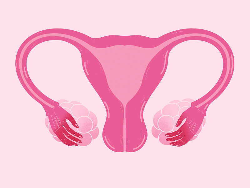 Pcos designs, themes, templates and downloadable graphic elements on ...