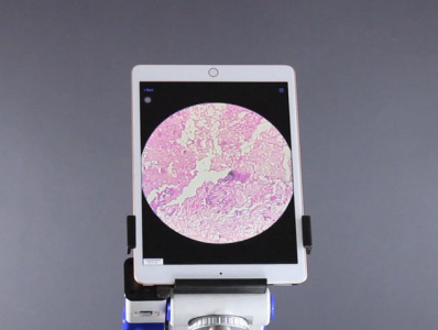 Pathology Benchtop Microscope - Laboratory Microscope - MedPrime by ...