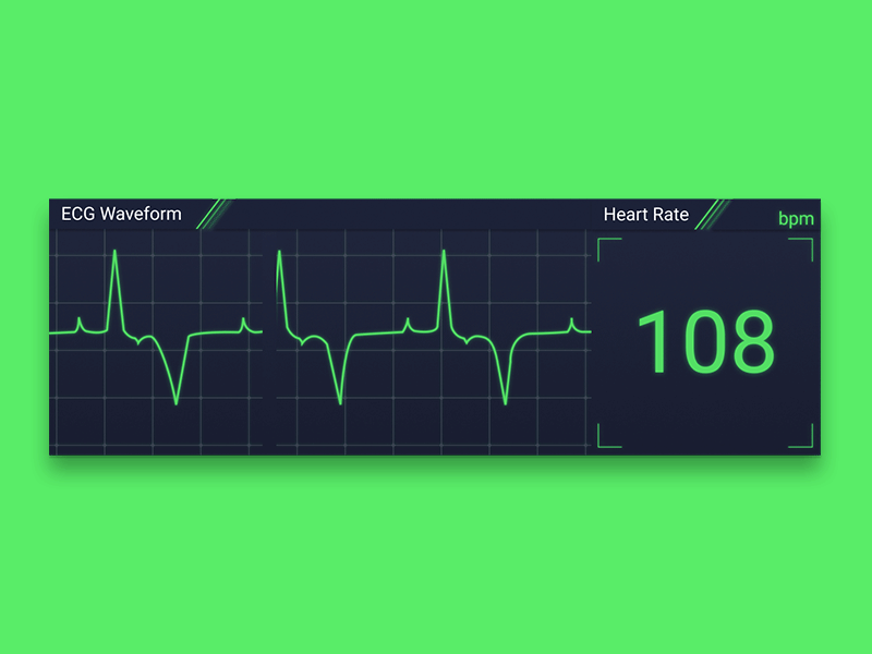ECG Waveform Panel by Matt Beevers on Dribbble