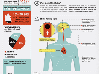 Atrial Fibrillation Poster - side 2 by Brad Woodard on Dribbble