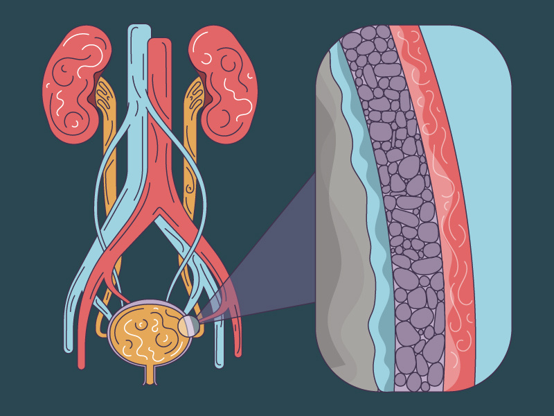 The Urinary System by Tyler Stockdale for Killer Visual Strategies on ...