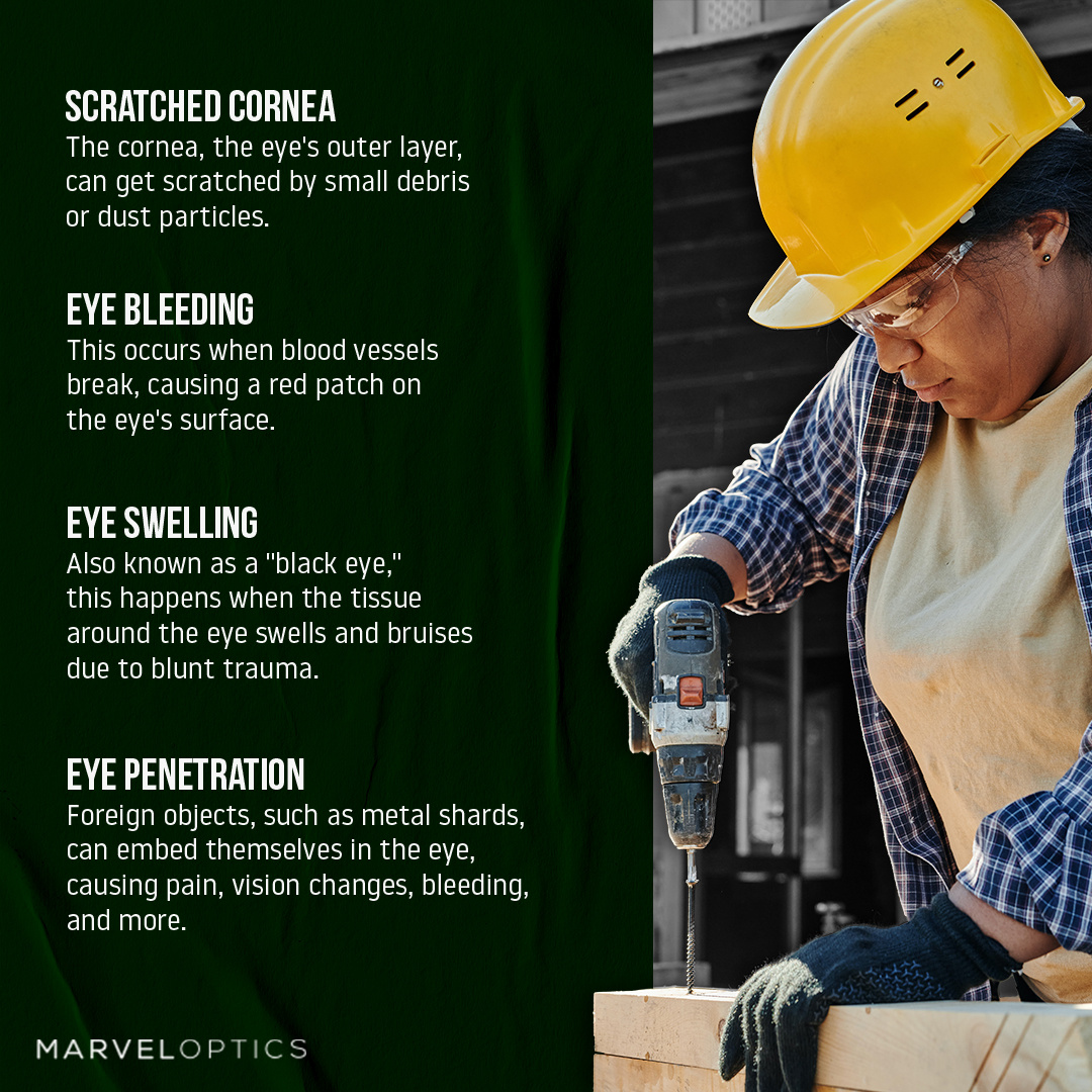 Common workplace eye injuries by Brent Joshua Genterone on Dribbble