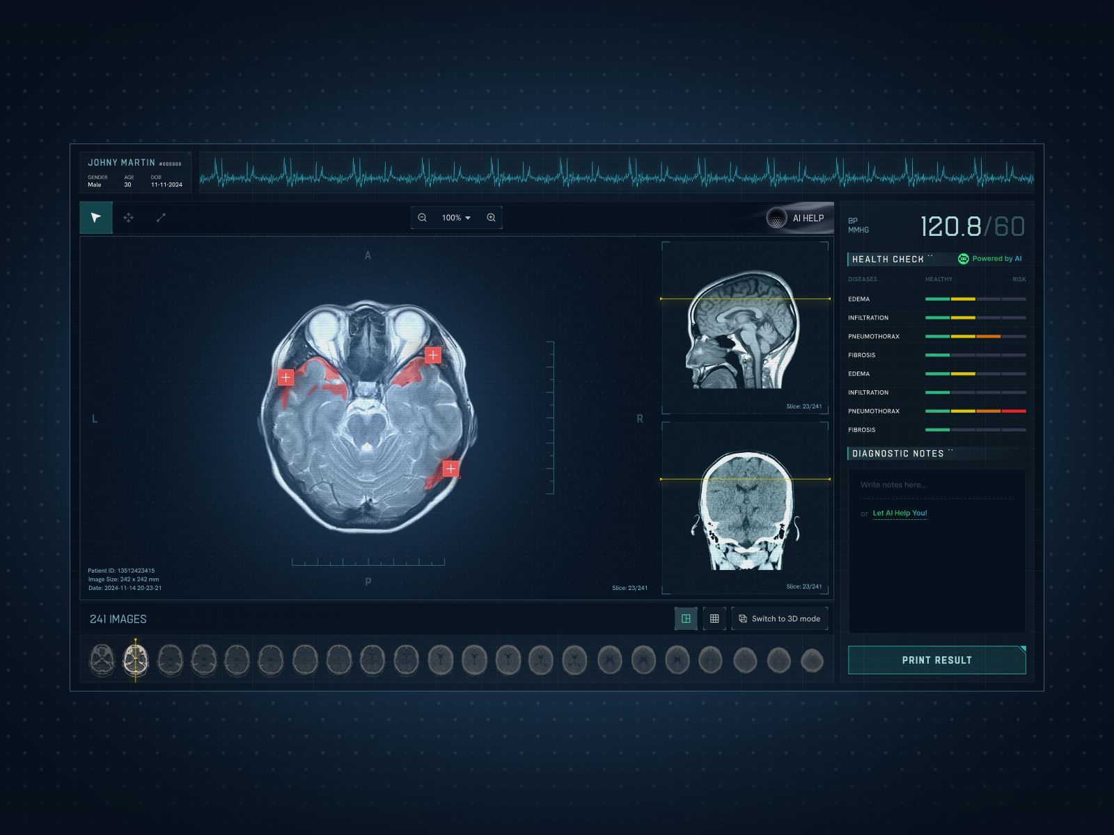 Neurovision - AI analyzing brain imaging data by 𝖕𝖍𝖆𝖕 🐰 for GST Studio ...