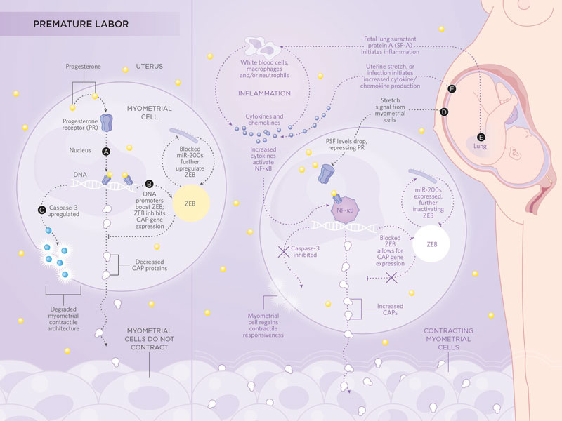 Premature labor by Lucy Reading-Ikkanda on Dribbble