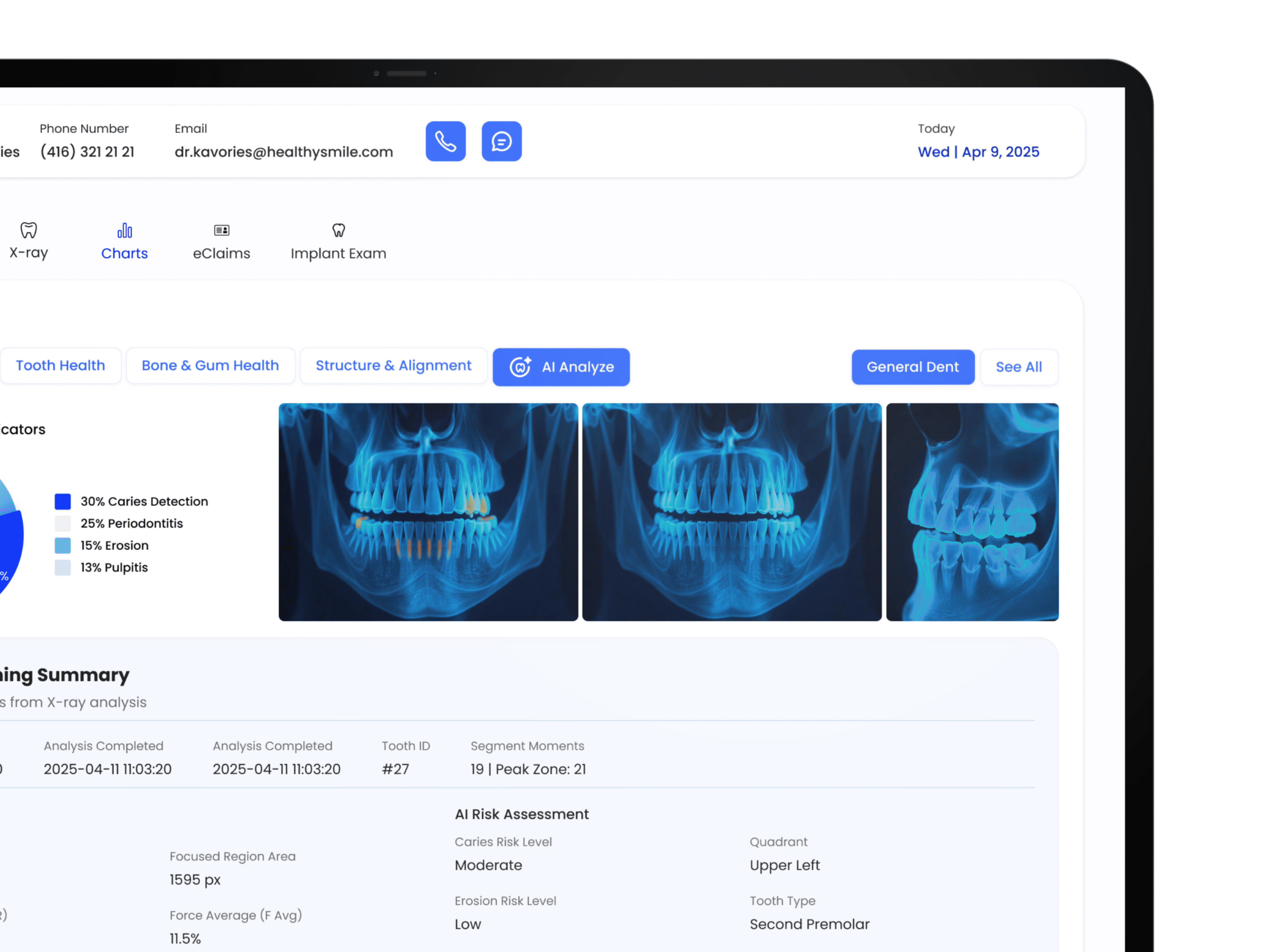 Dental Diagnostic | AI | X-ray Assistant by Anna Deineka on Dribbble