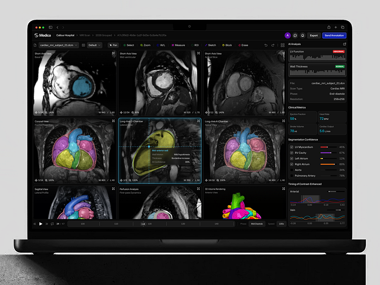 Cardiac MRI Scan Analysis by Alfikri Djati for Callour Studio on Dribbble