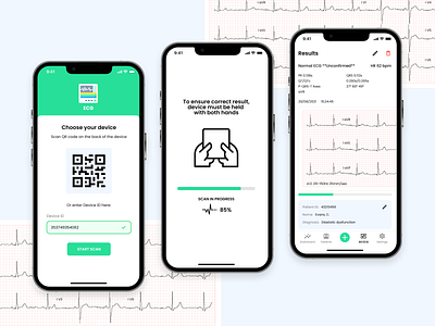 Medical app for ECG recording by Oleksandra Paramieieva on Dribbble