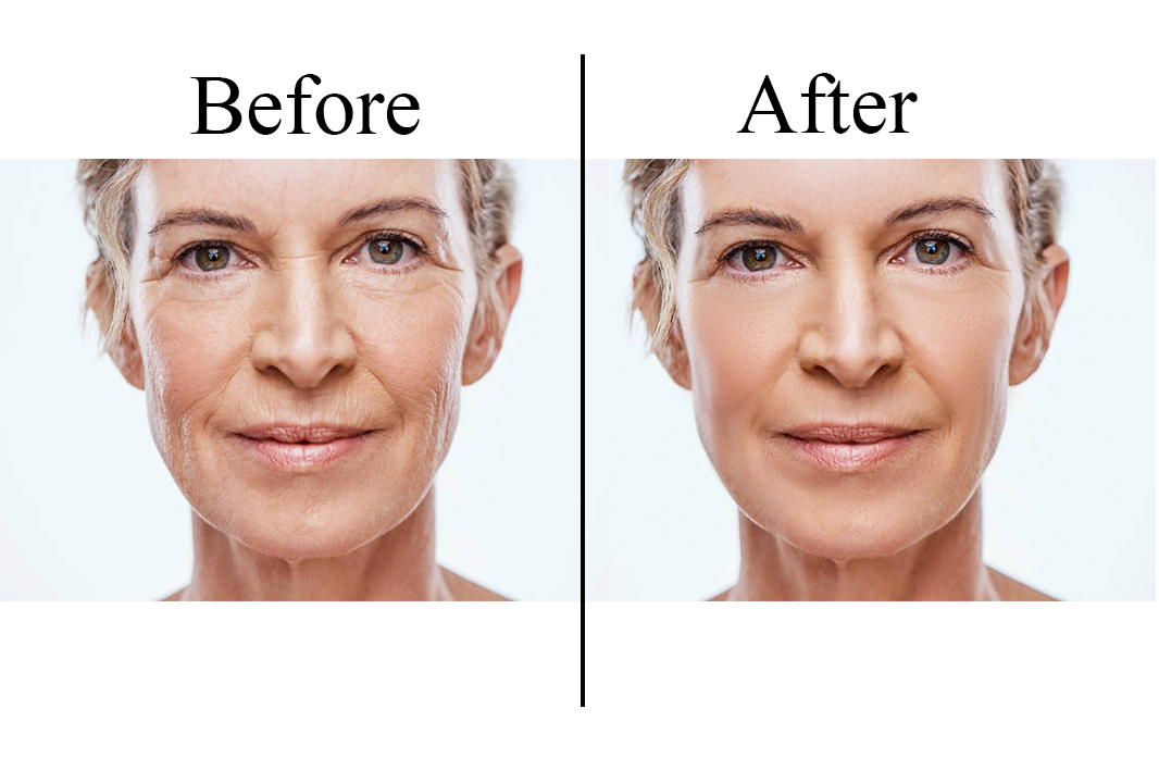 High Definition Face Retouch I PS by Najmul Hossain on Dribbble